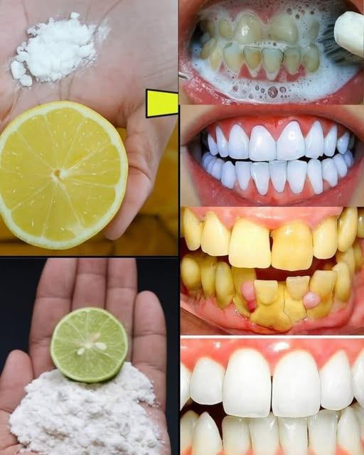 Discover the Hidden Sparkle: Transform Your Smile with the Baking Soda ...